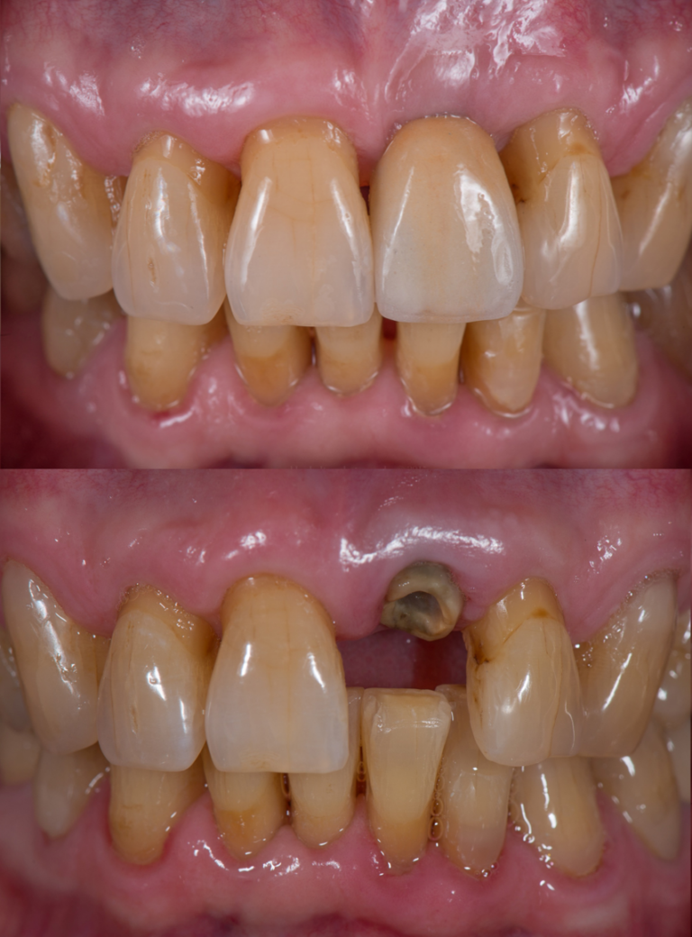 Heart Dental – Dentist in Carson – Complete Dental Solutions